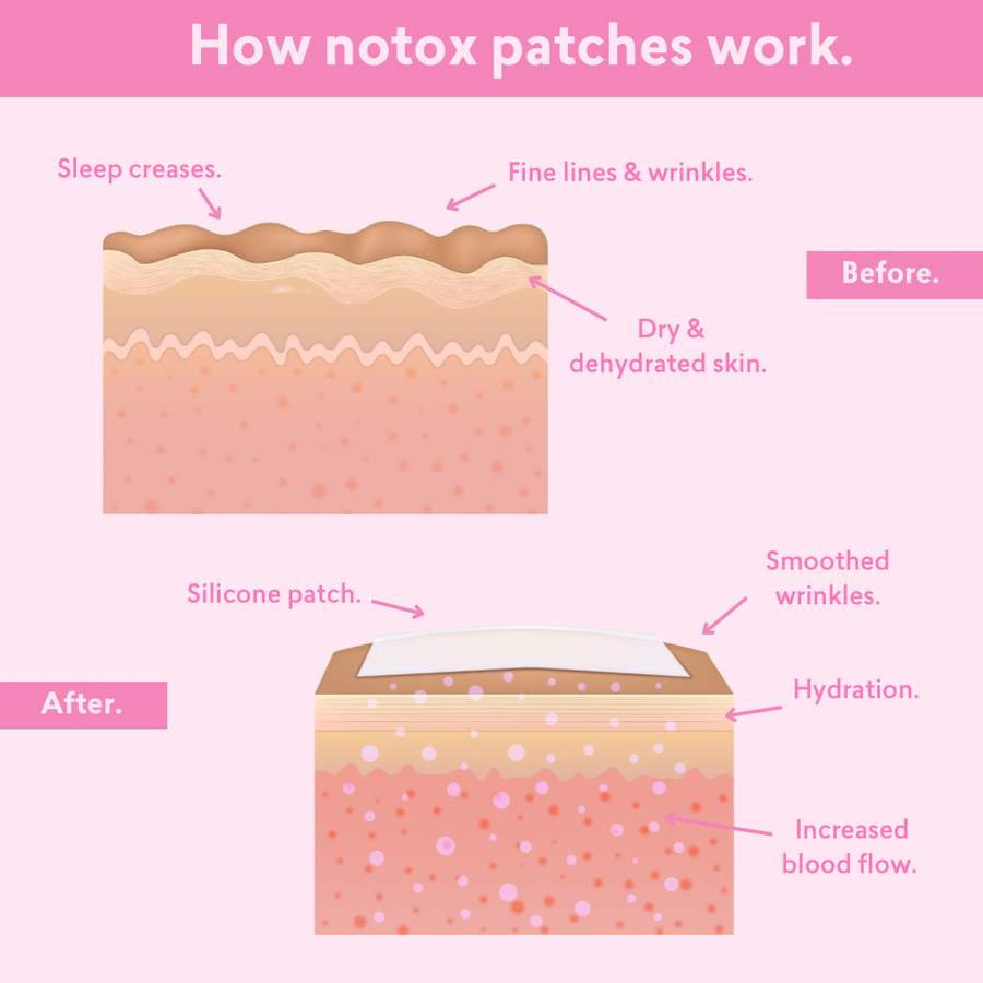 Notox - Forehead + Frown Lines Silicone Wrinkle Patch – Nudie Face